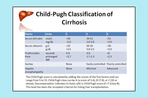 Bệnh xơ gan: Nguyên nhân, triệu chứng, chẩn đoán, cách điều trị